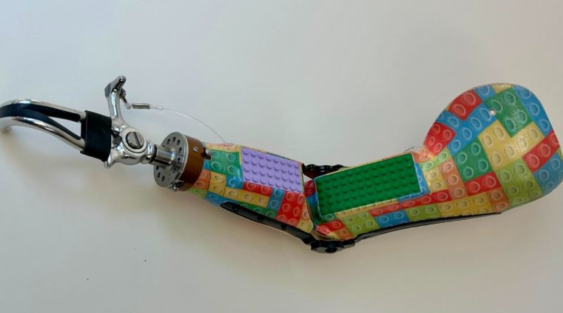 Custom LEGO prosthetic expands play possibilities